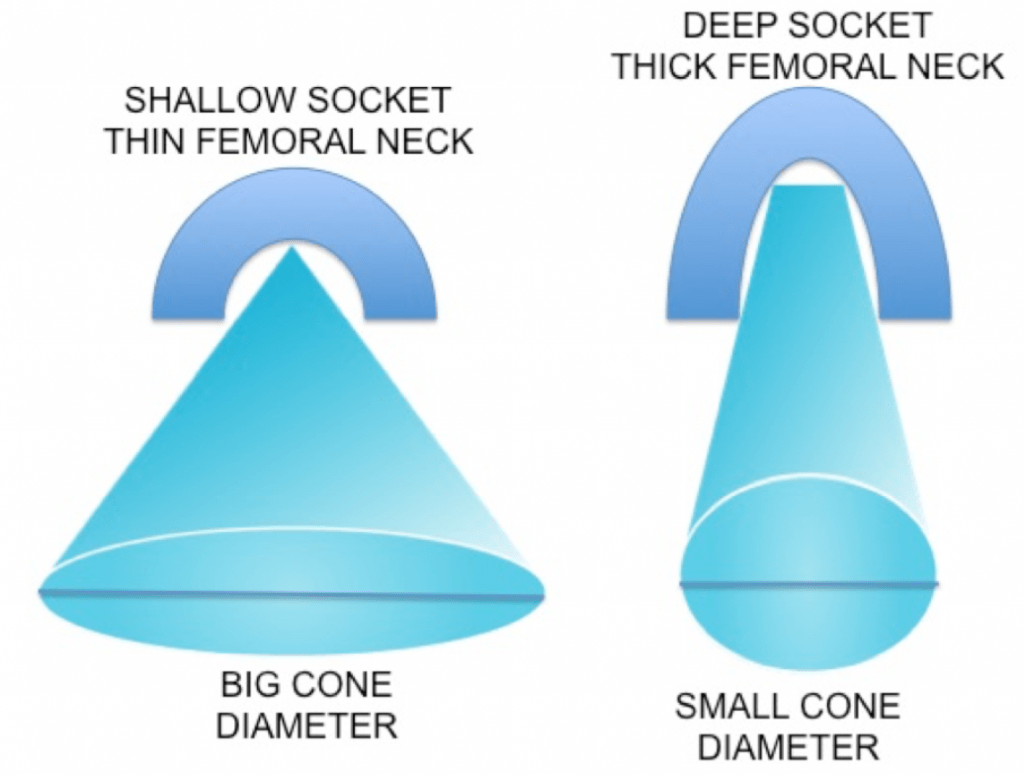 How Your Anatomy Influences Your Squat Mechanics - JC Fitness